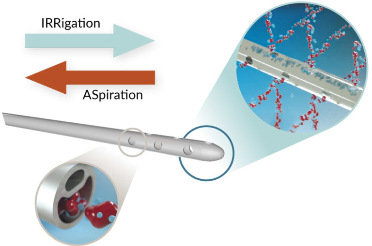Brochure-Infographic - IRRAS