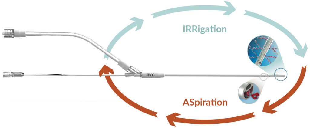 IRRAflow Irrigation Aspiration - IRRAS